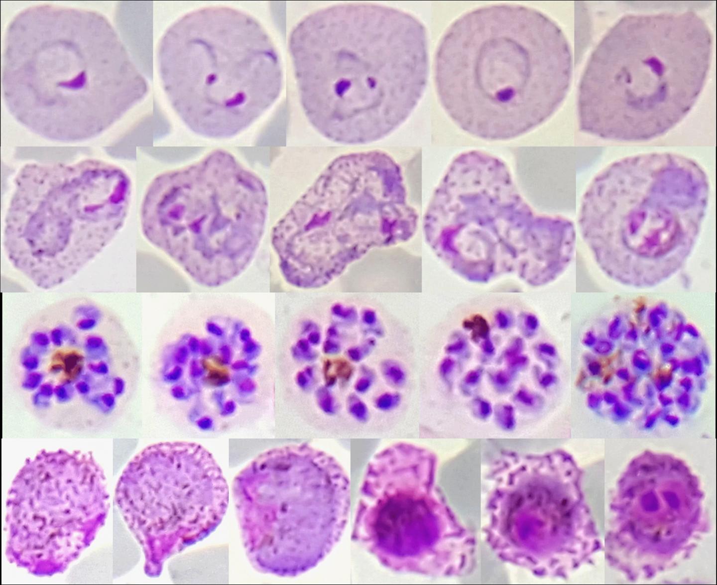Storage House Of Malaria Parasite At James Loch Blog