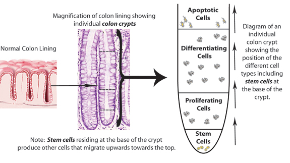 Sentinel cells keep watch over your gut | Microbiology