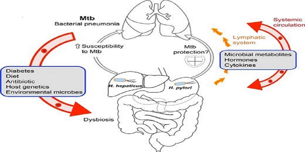 The Role of the Gut-Lung Axis in the Development of Tuberculosis | Health And Medicine