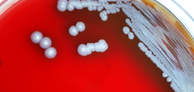 How A Virus Impacts a Bacterium that Infects People | Microbiology