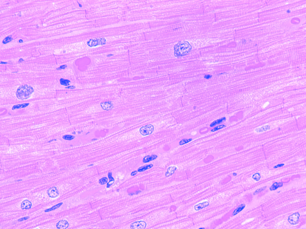 What Causes Chemotherapy-Induced Heart Damage? | Health And Medicine