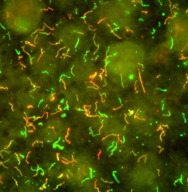 Lyme Disease Cell Structure