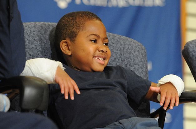 First Pediatric Bilateral Hand Transplant a Succ | Health And Medicine