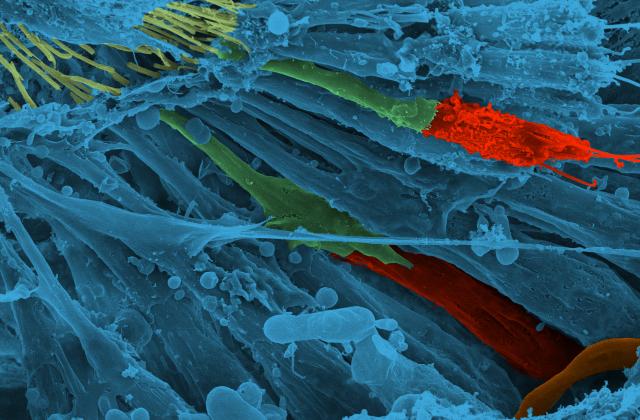 Goggatomy: for the Study of Live Cells Within Exoskeletons | Cell And ...