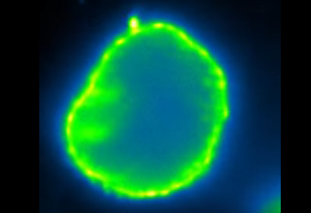 Artificial Cell Membrane Capable of Remodeling is Created | Cell And ...