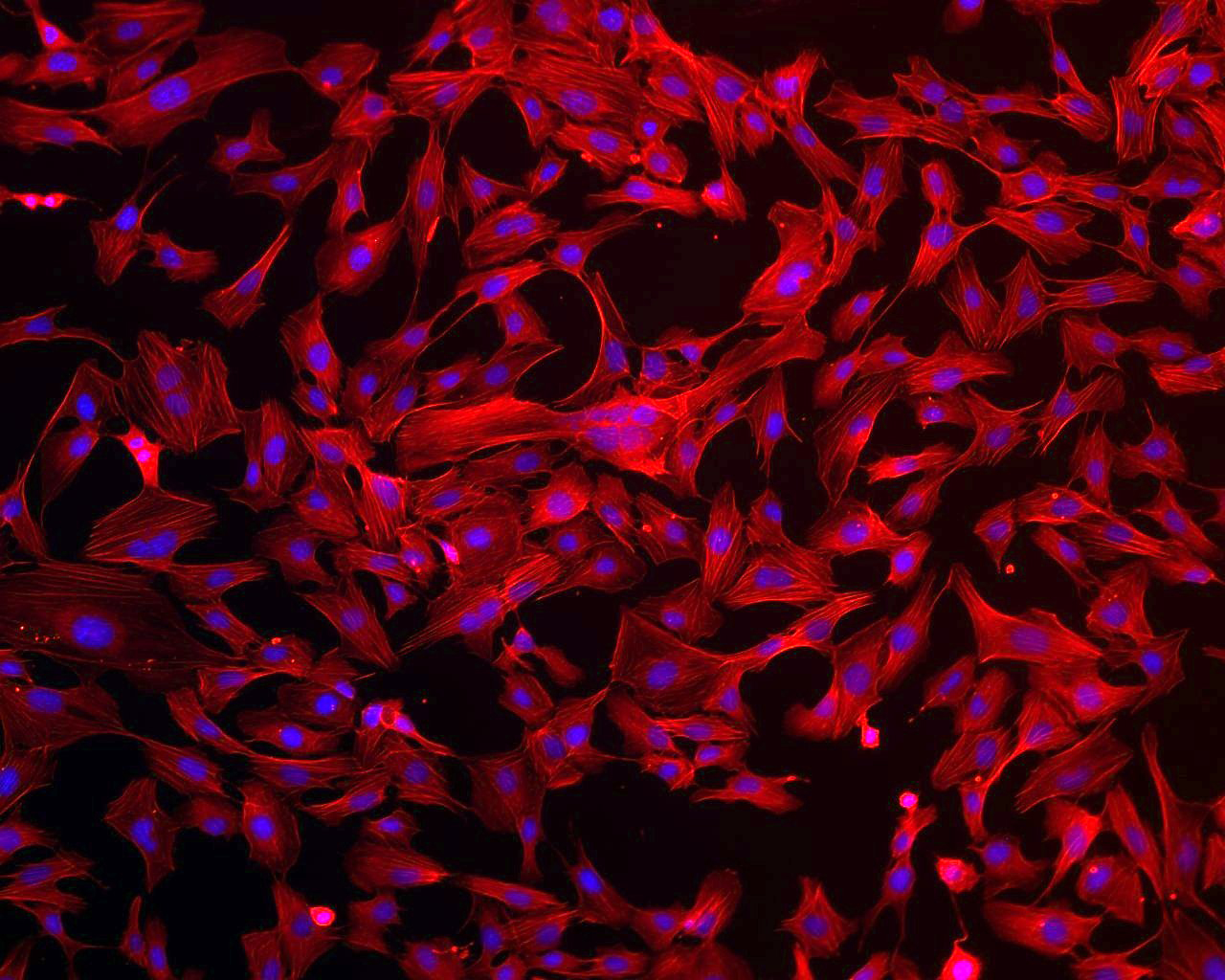 Building Better Blood Vessels with Starved Stem Cells | Cardiology