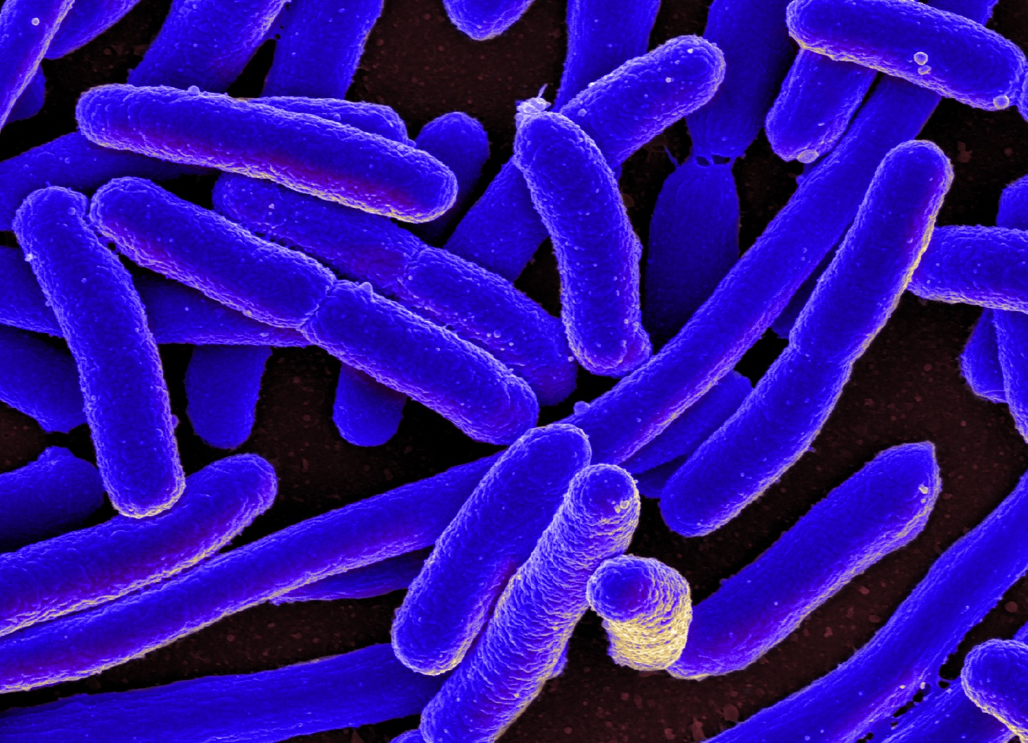 Analysis of Human Microbiome Yields Potential new Antibiotic | Microbiology